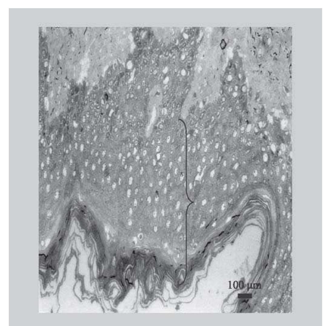 - light microscope micrograph of human skin after treatment