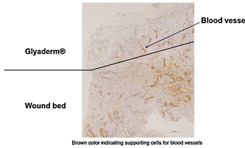- histological analysis (asma staining) visualizing blood