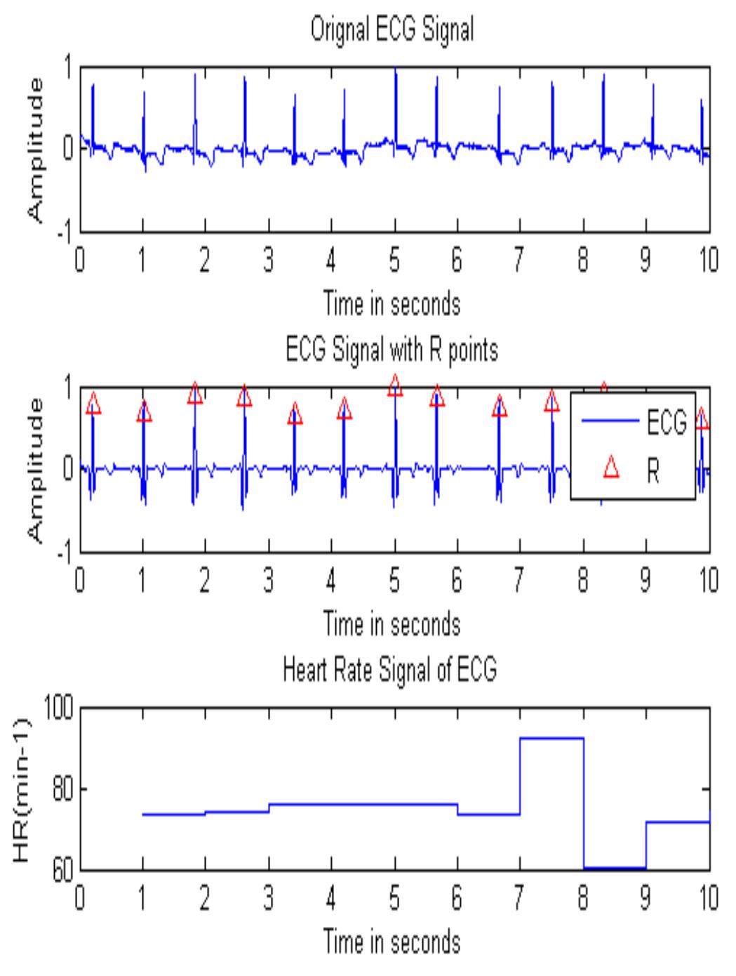 -4: original ecg signal, ecg signal with r-peaks an heart