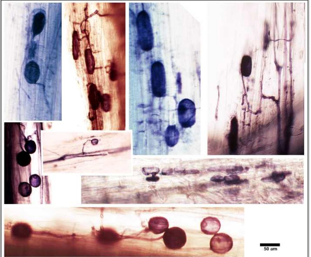 4 examples of endomycorrhizal fungal infection of wheat