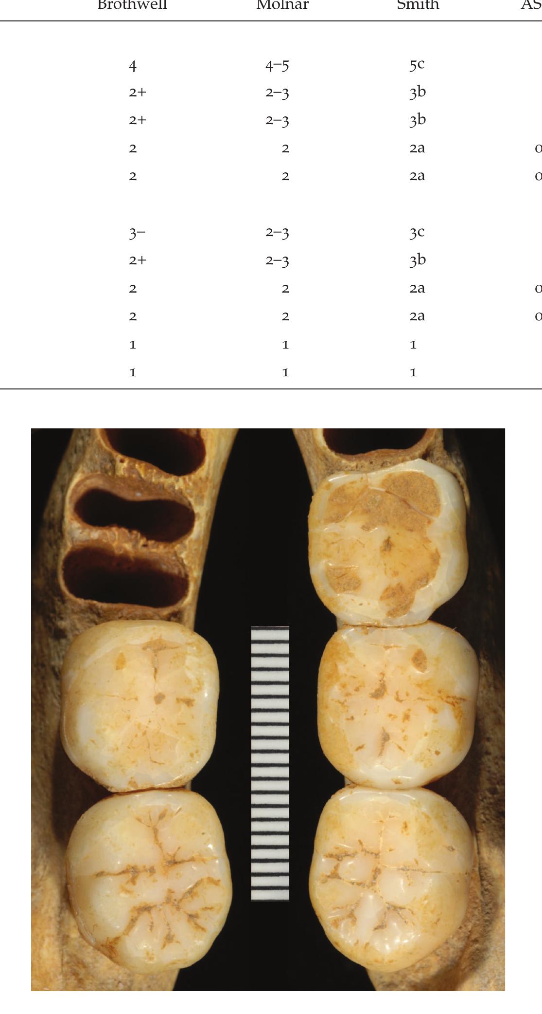 3. occlusal views of the oase 1 mandibular molars and the