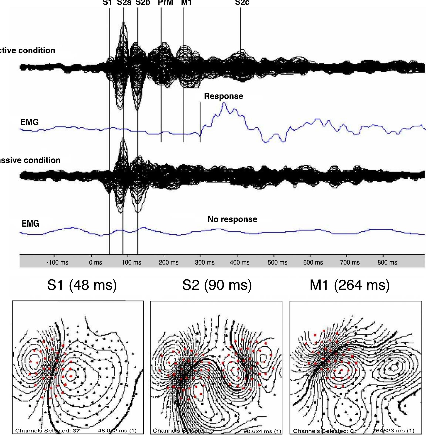 Examples of averaged erf waveforms for a representative