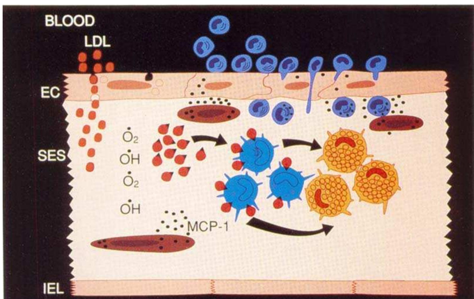 Figure 2 - from The pathogenesis of atherosclerosis: an