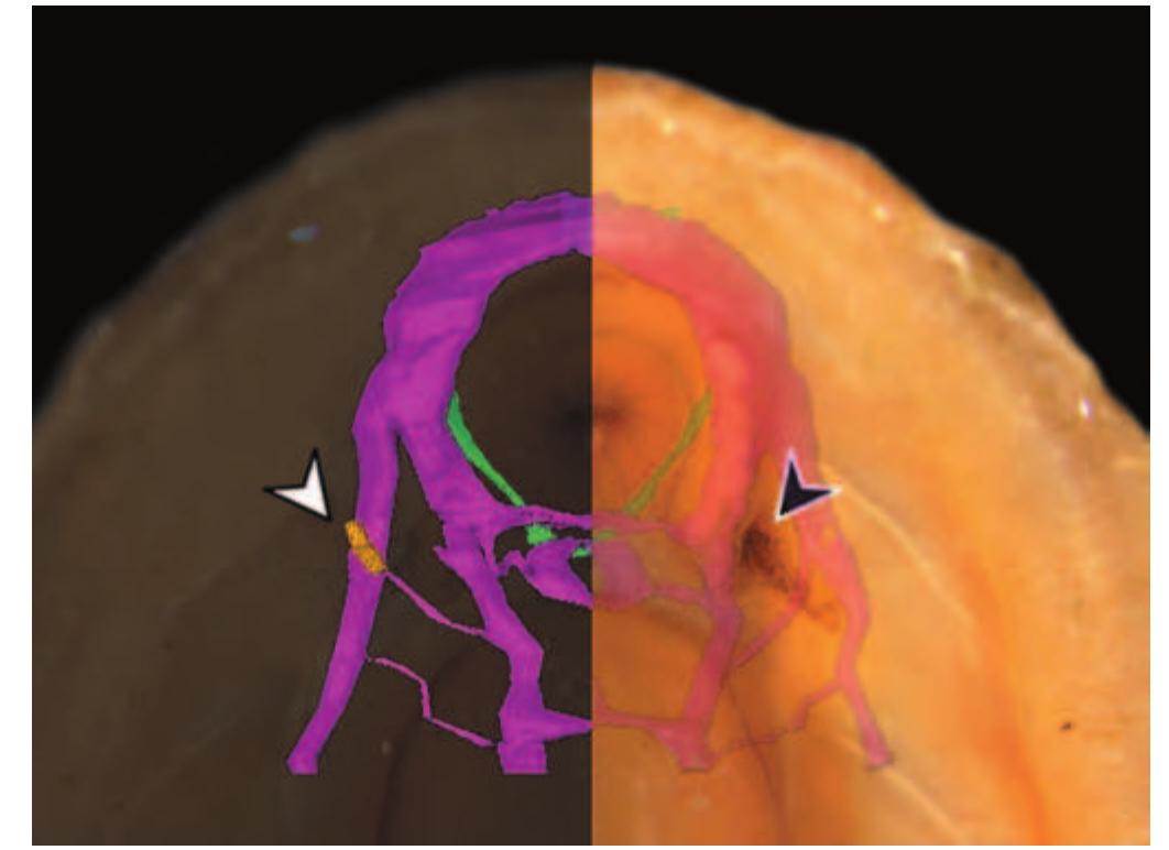 6. polyplacophora: the anterior nervous system of