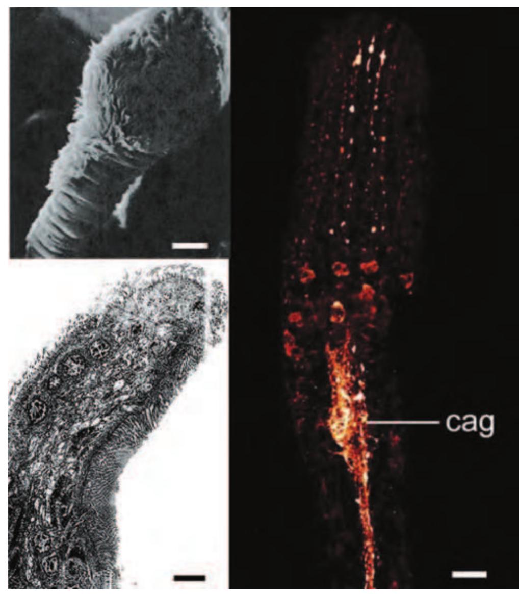 (PDF) Mollusca: Caudofoveata, Monoplacophora, Polyplacophora ...