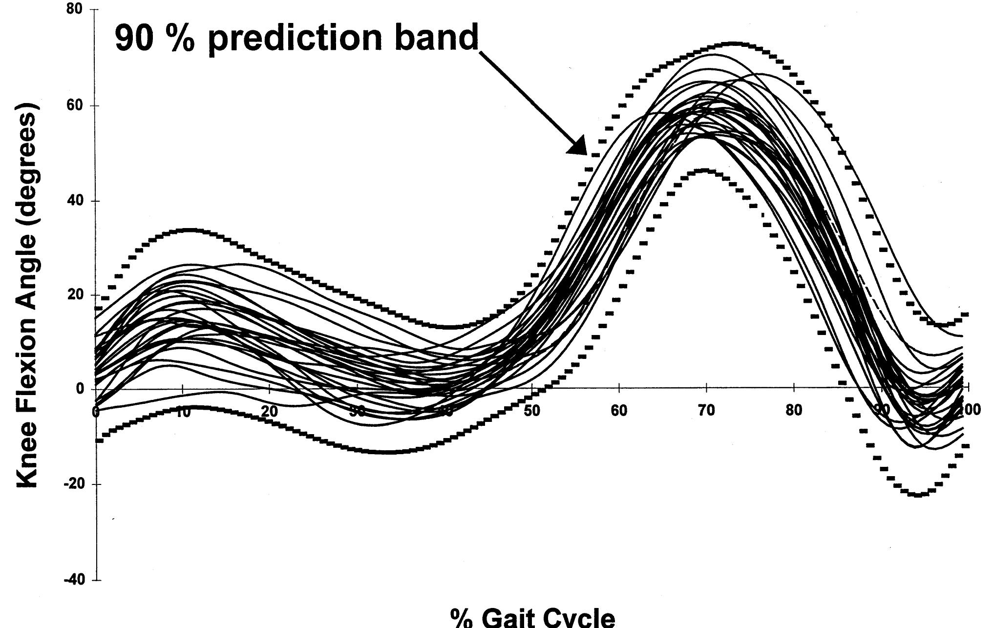 Knee flexion angle versus percent gait cycle for 28 normal