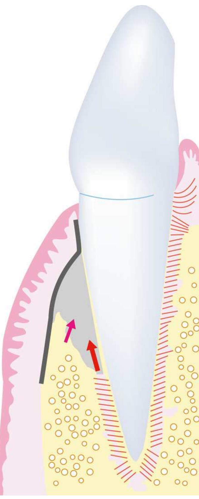Schematic drawing illustrating the principle of guided
