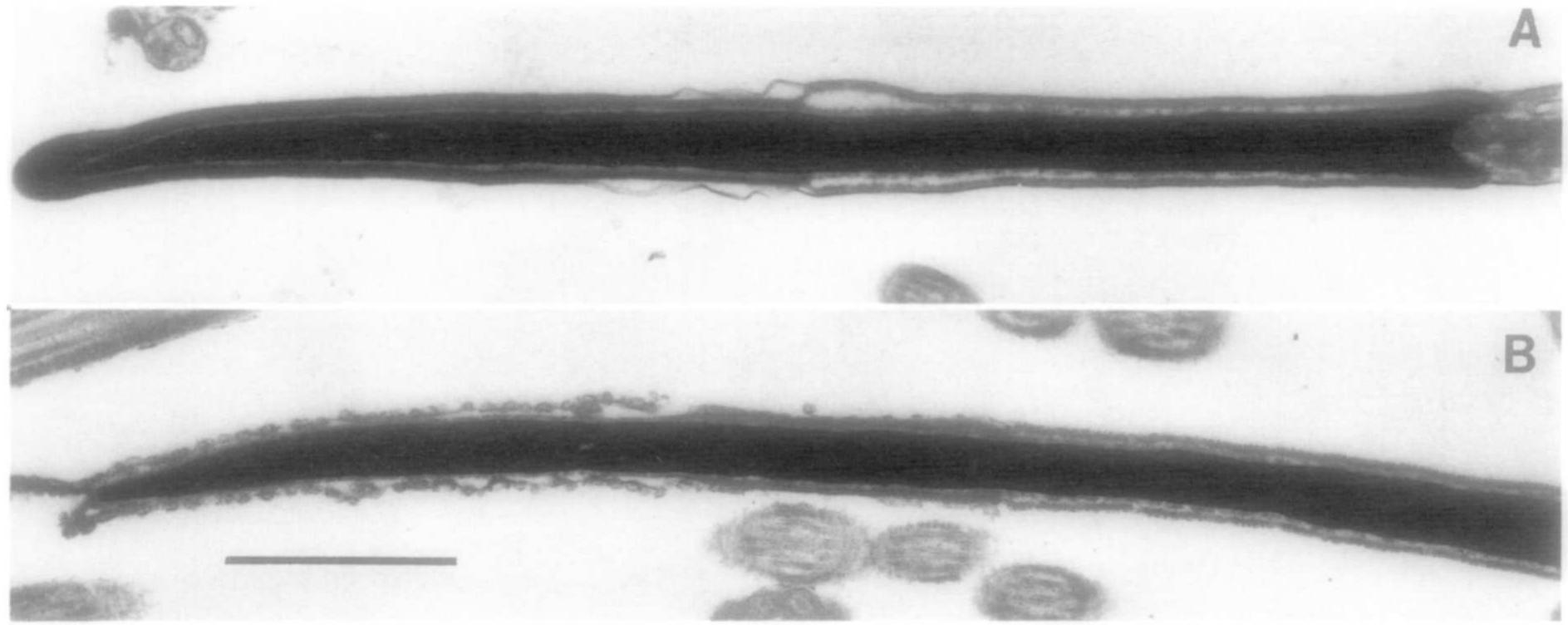 Electron micrographs of untreated bull sperm (a) and bull