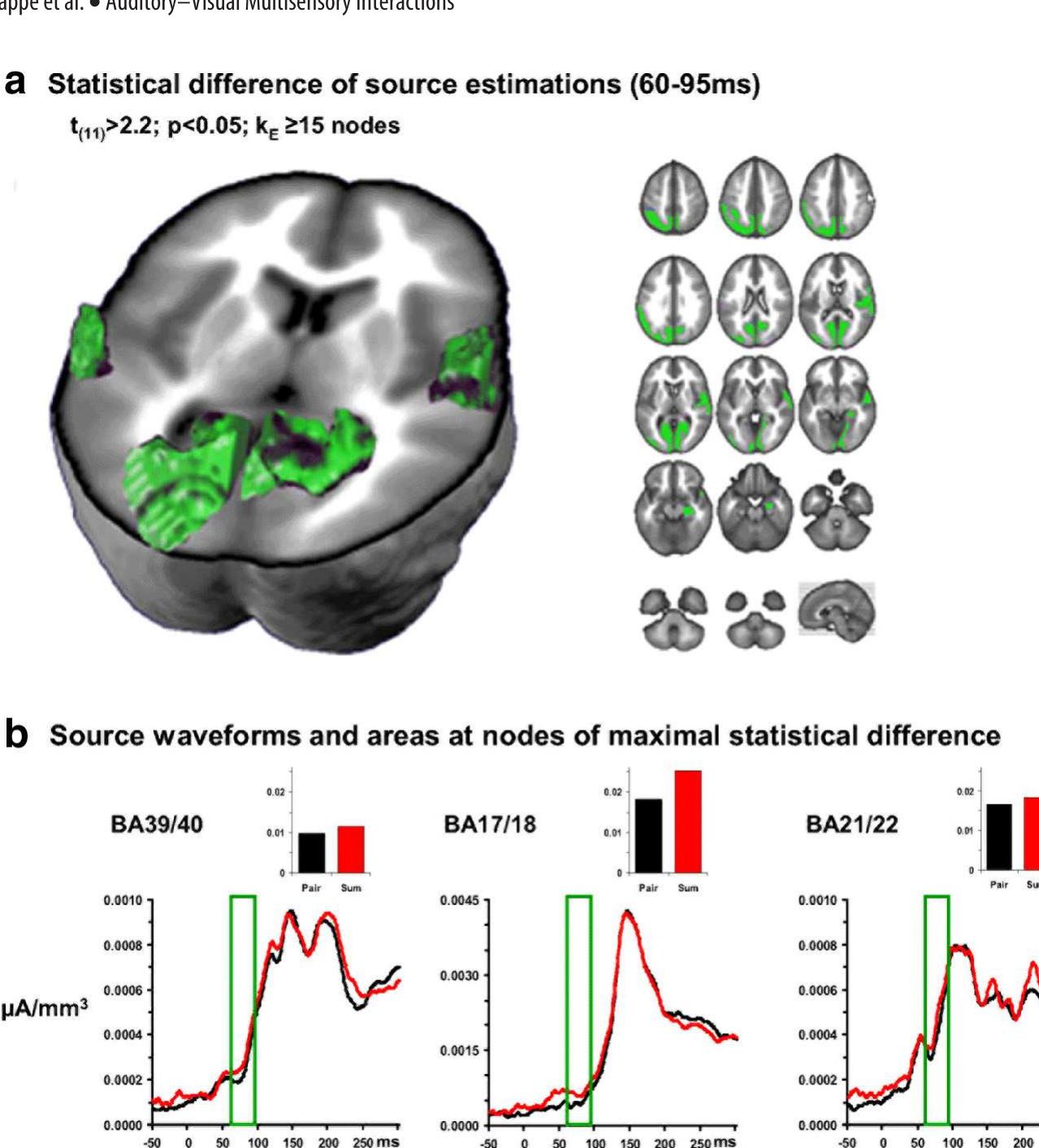 Figure 4 - Auditory-Visual Multisensory Interactions in