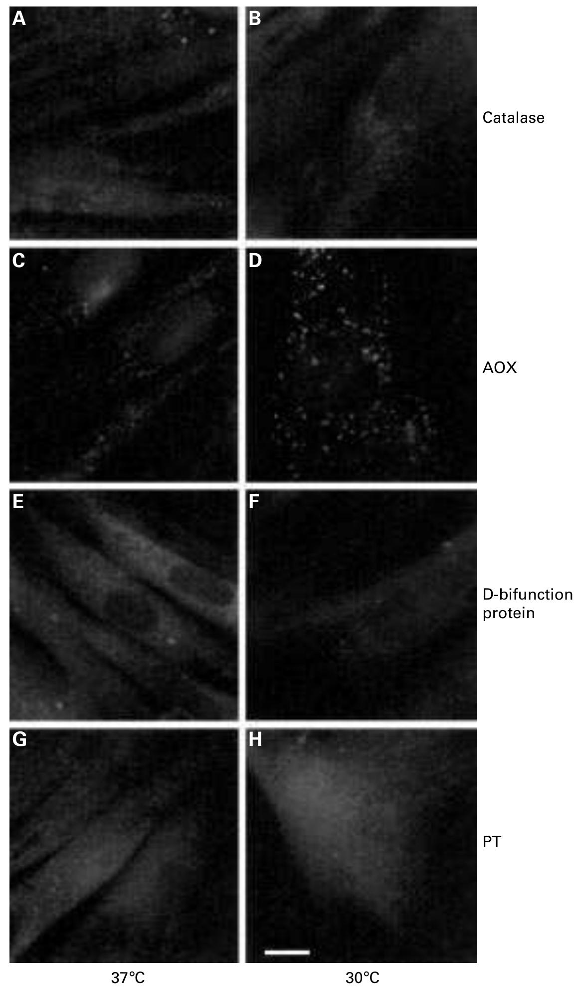 Immunofluorescent staining for antibodies of peroxisome