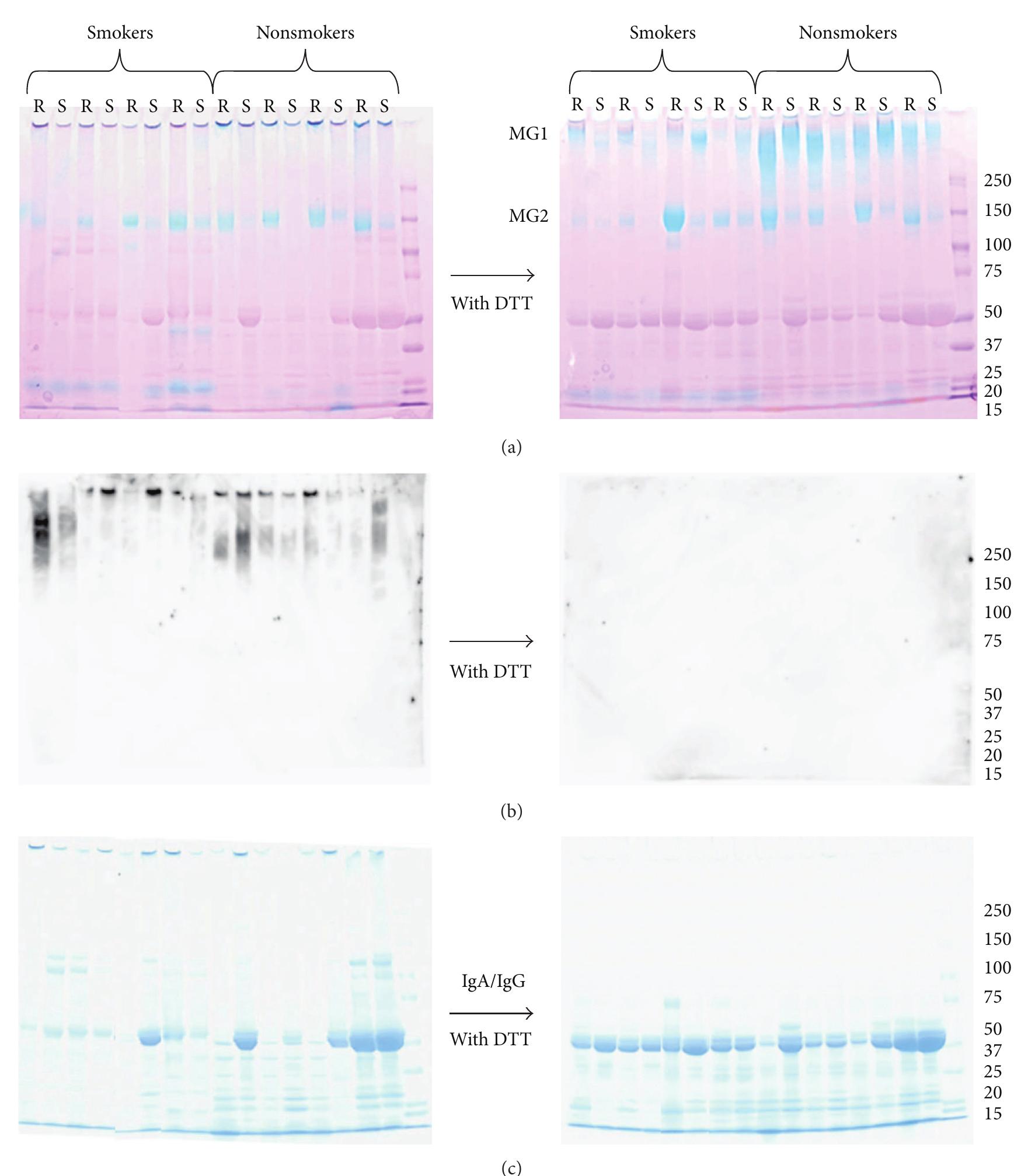 Sds-page profiles of saliva proteins from smokers and