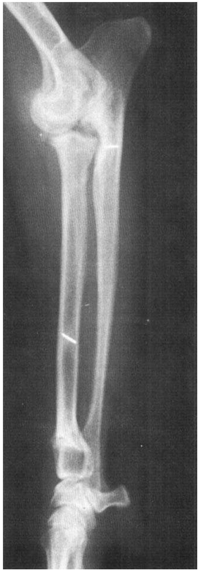 Lateral radiograph of right forelimb from a dog with pcdrp