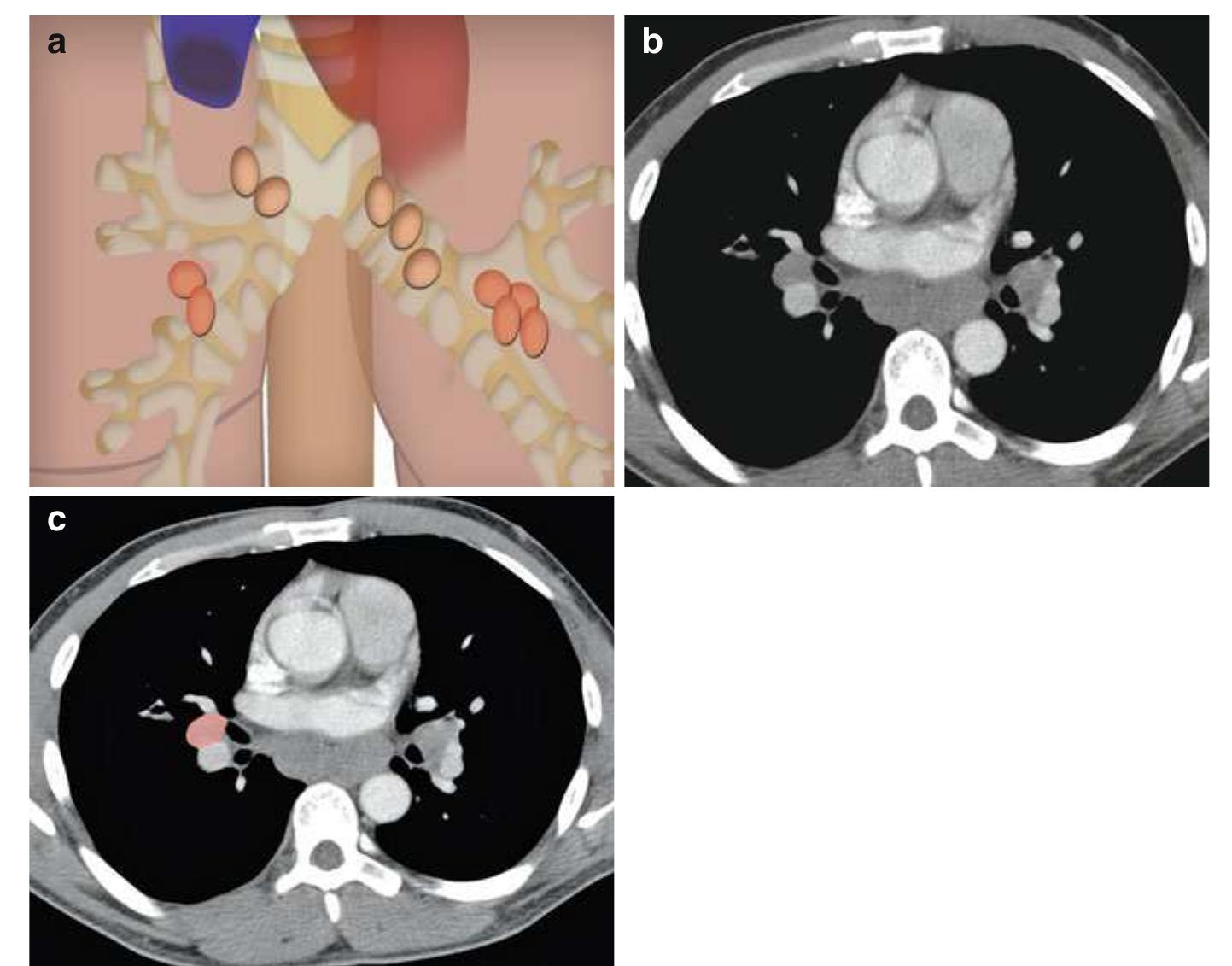 25 (a) schematic illustration shows the anatomic location