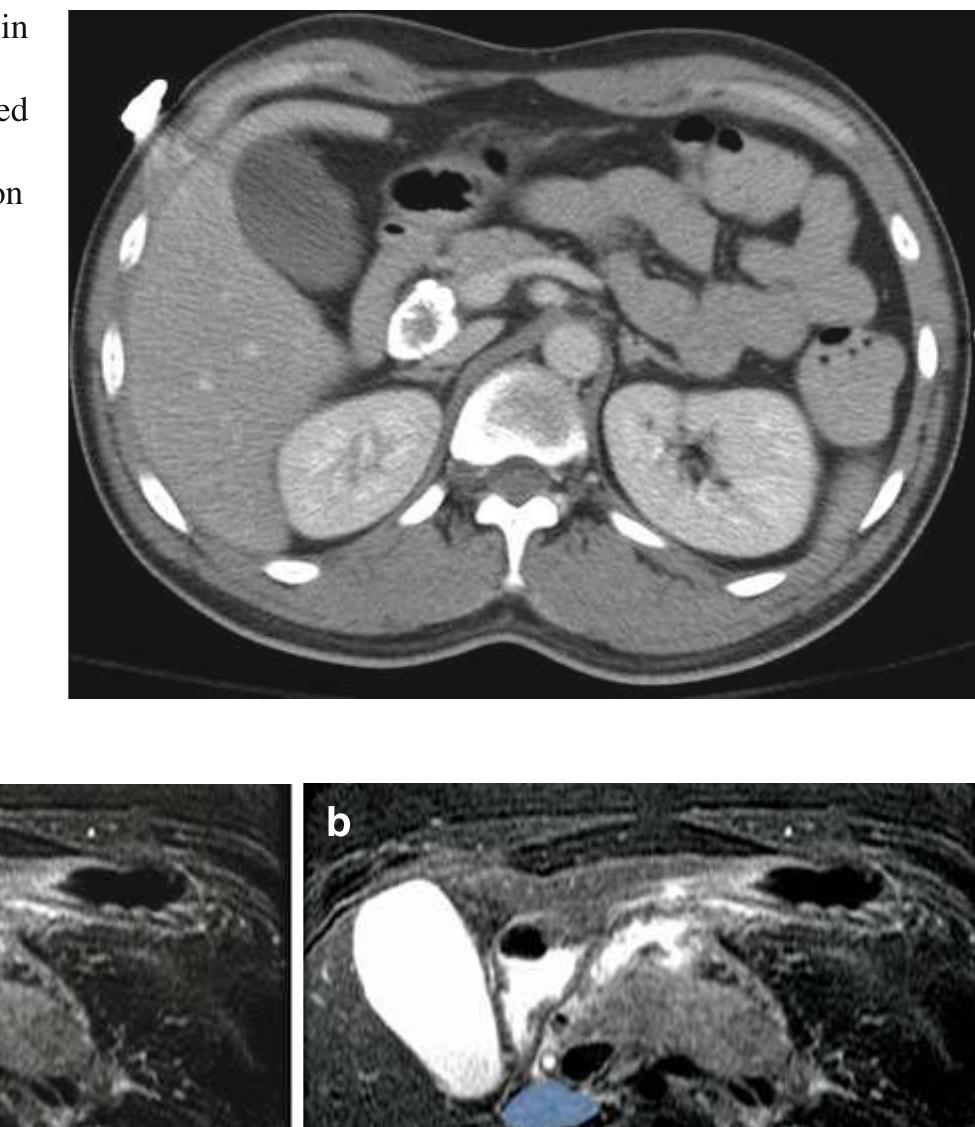 Figure 107 - Atlas of Lymph Node Anatomy