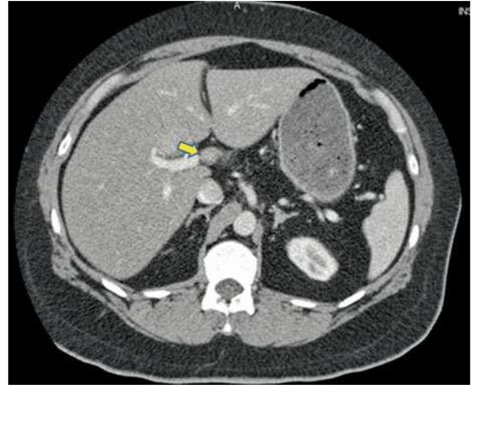 Figure 181 - Atlas of Lymph Node Anatomy