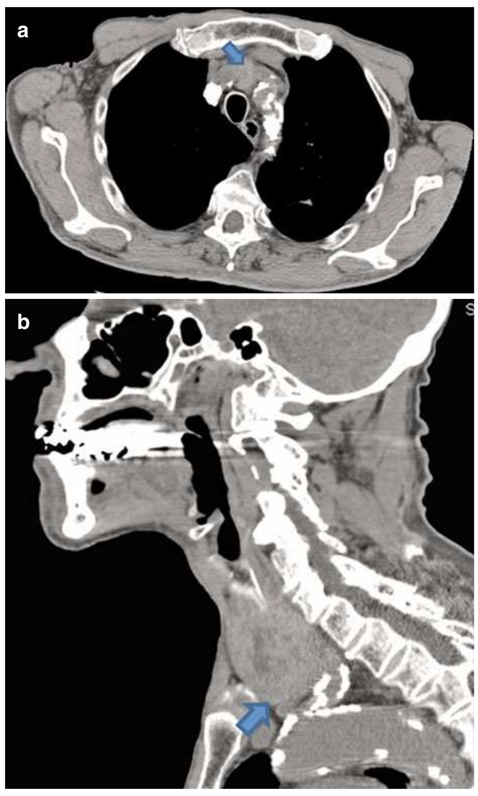 Figure 182 - Atlas of Lymph Node Anatomy