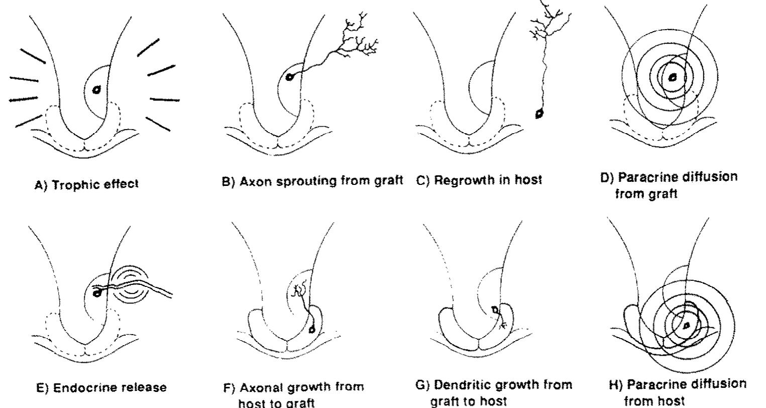 Possible mechanisms of action of ventricular grafts. the