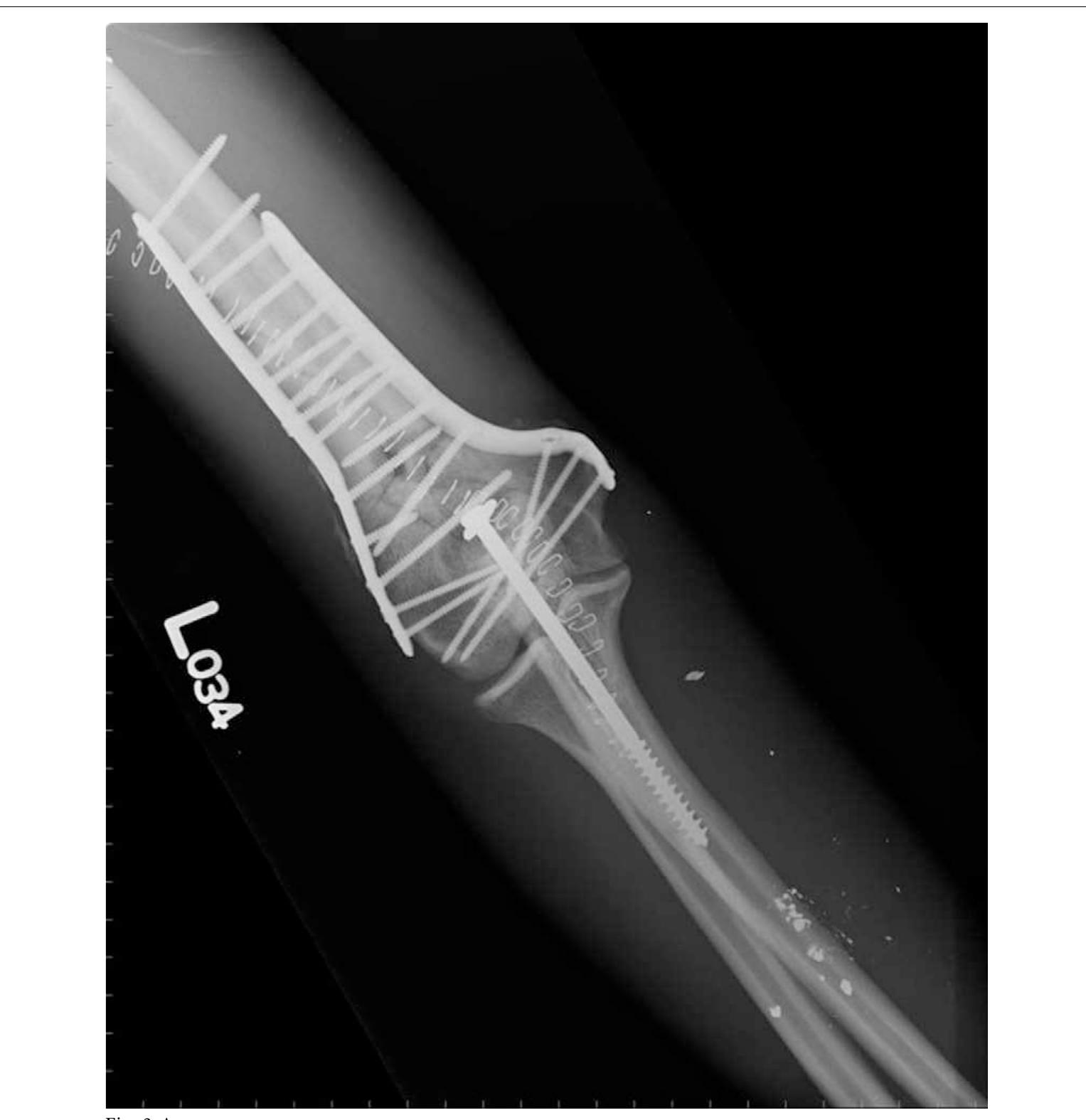 Anteroposterior (fig. 3-a) and lateral (fig. 3-b)