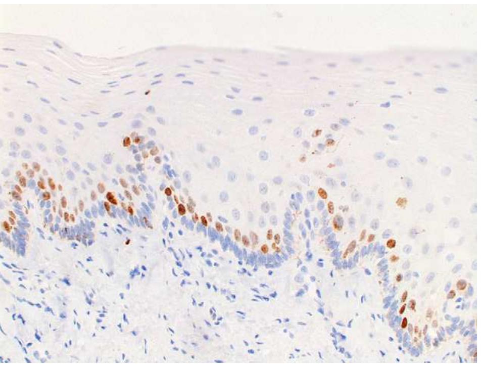 Normal mucosal epithelium of the oesophagus immunostained