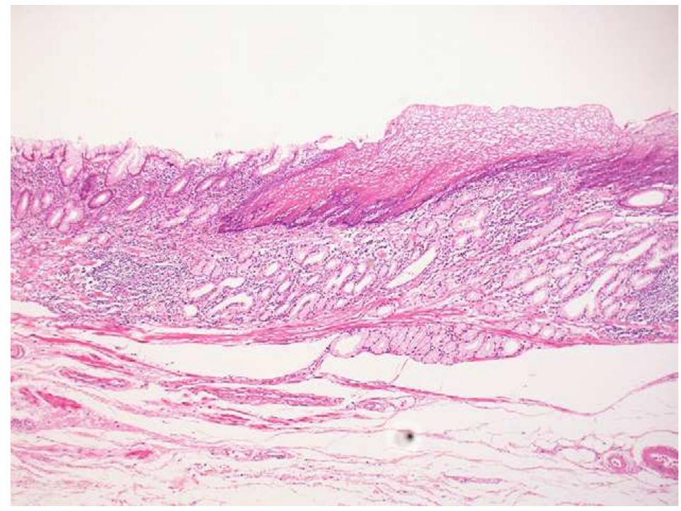 Glands also known as superficial glands) show continuity