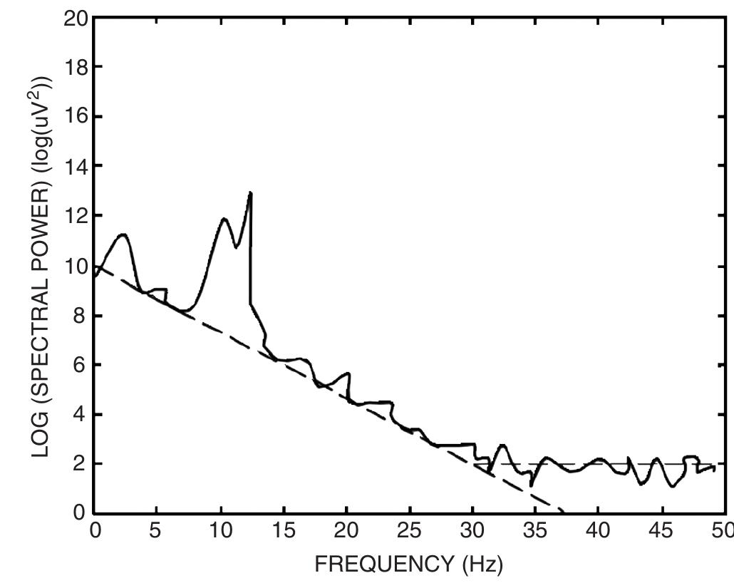 Typical power spectrum of a biopotential signal measured