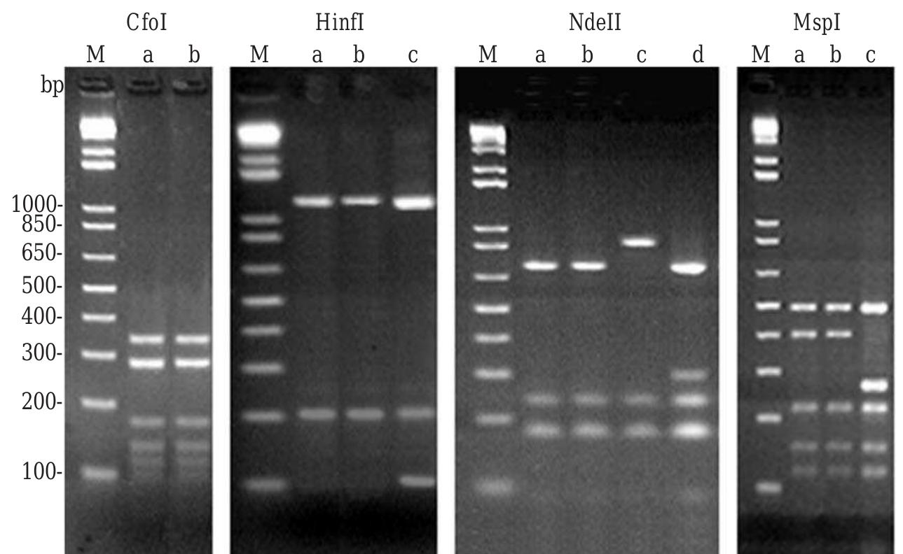 Agarose gel electrophoresis of 16s-rflp products from some