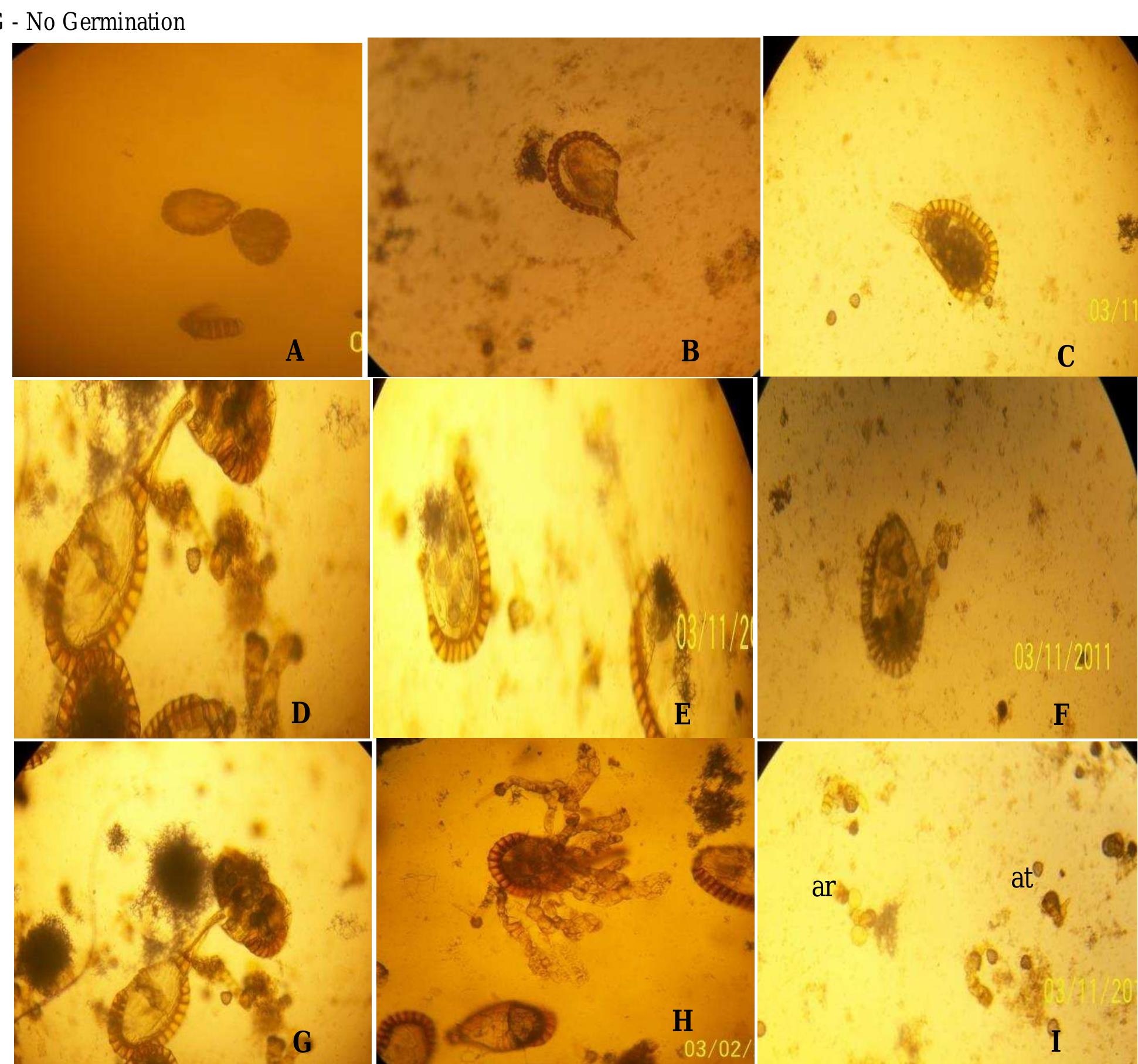 Plate 1: showing different stages of spore germination and