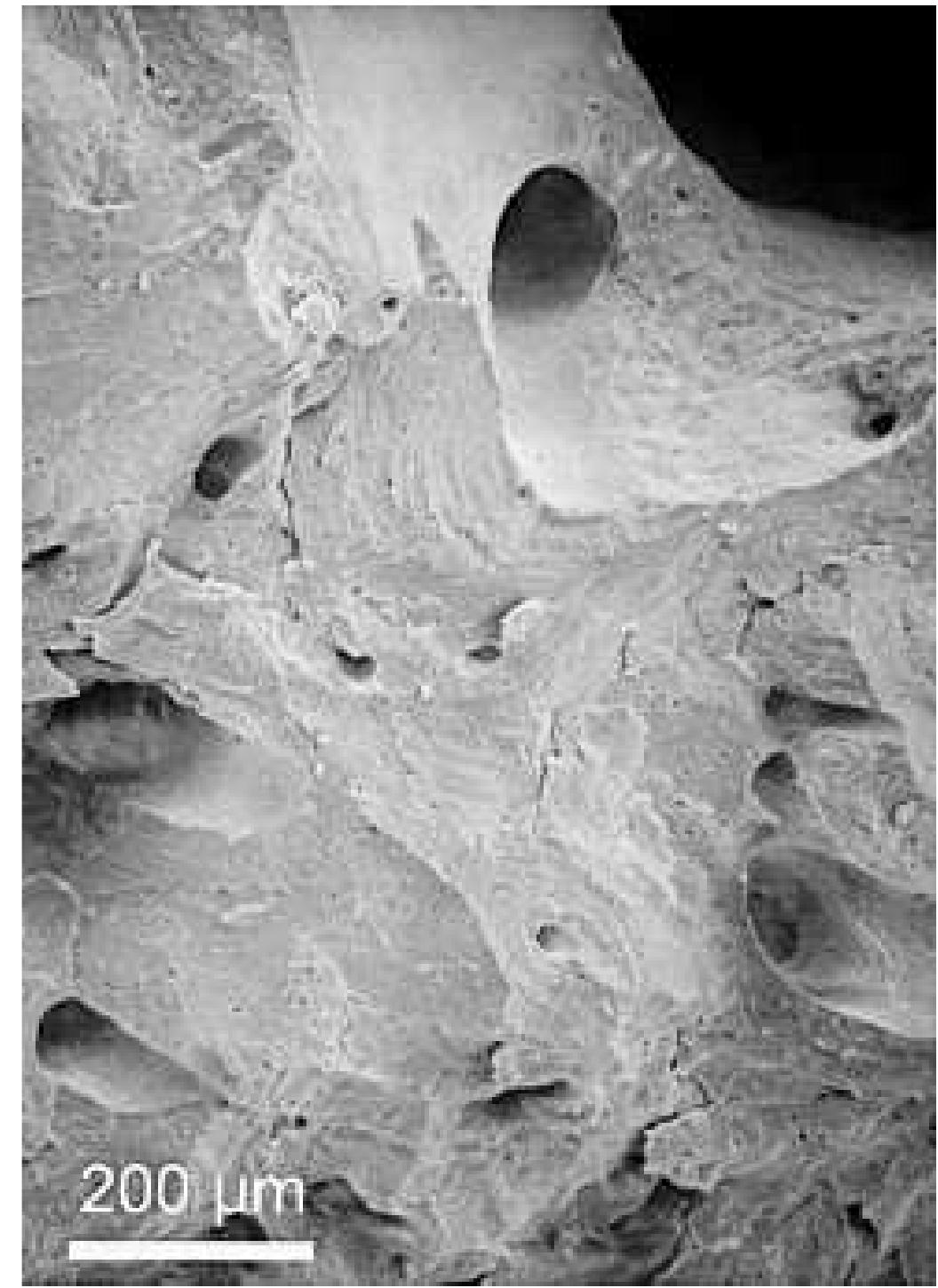 —a close-up at 100. of the straight transverse fracture