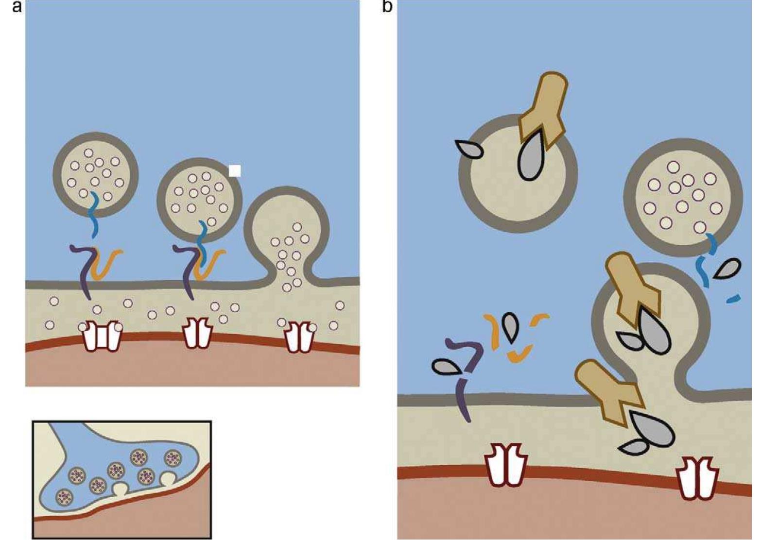 (a) lower figure depicts normal nerve ending to muscle