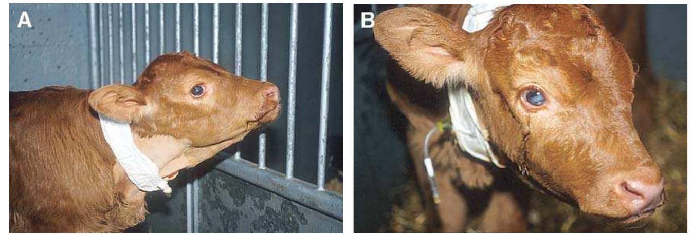 Figure 1 - from Bacterial meningitis and encephalitis in
