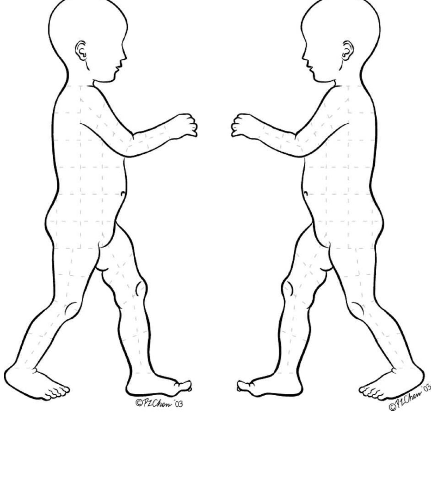 Figure 4 - Cellulitis at injection site: Case definition and