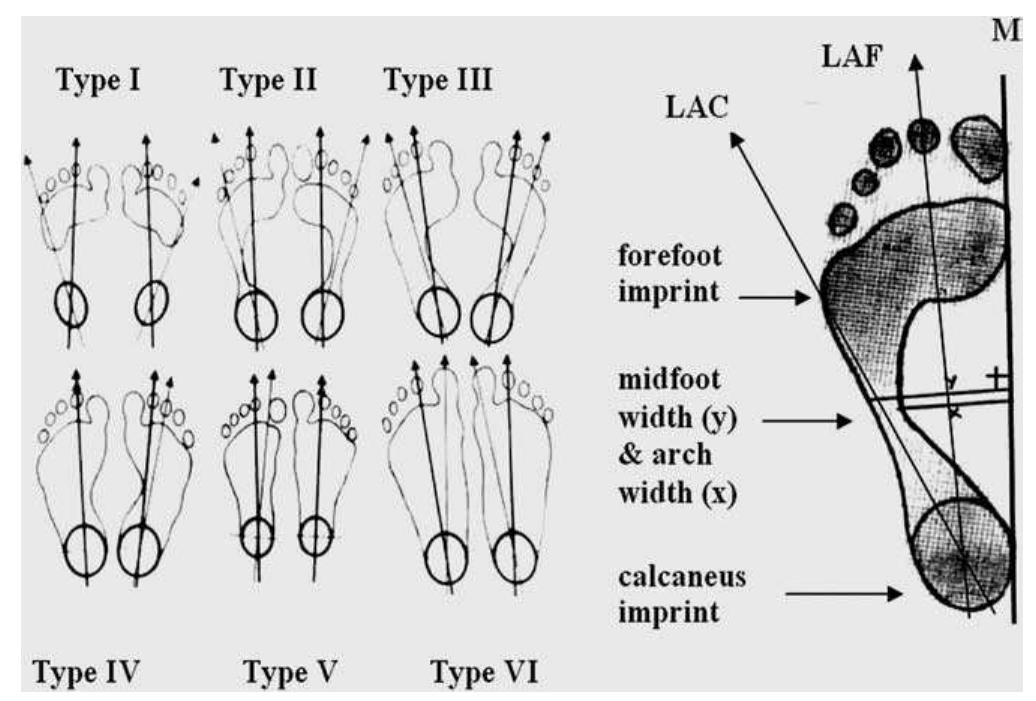 A typical footprint and the 6 footprint types are shown. the
