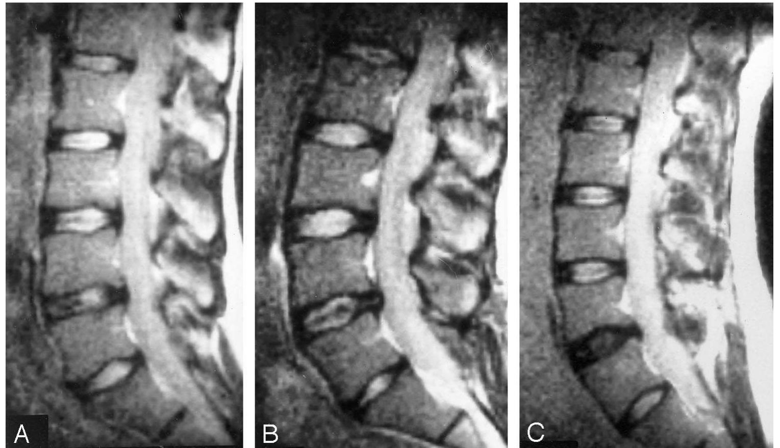 Examples of sagittal t2-weighted mr images of young men with