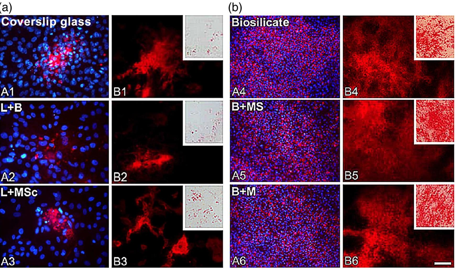 Epifluorescence of osteogenic cultures of coverslip glass