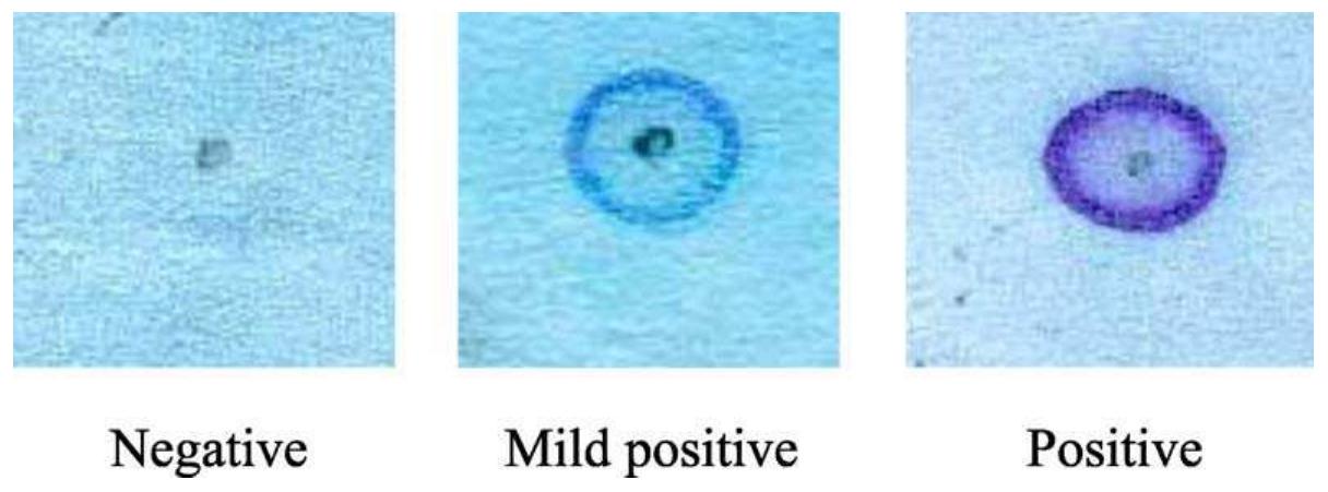 Interpretation of the berry spot test. usually, the