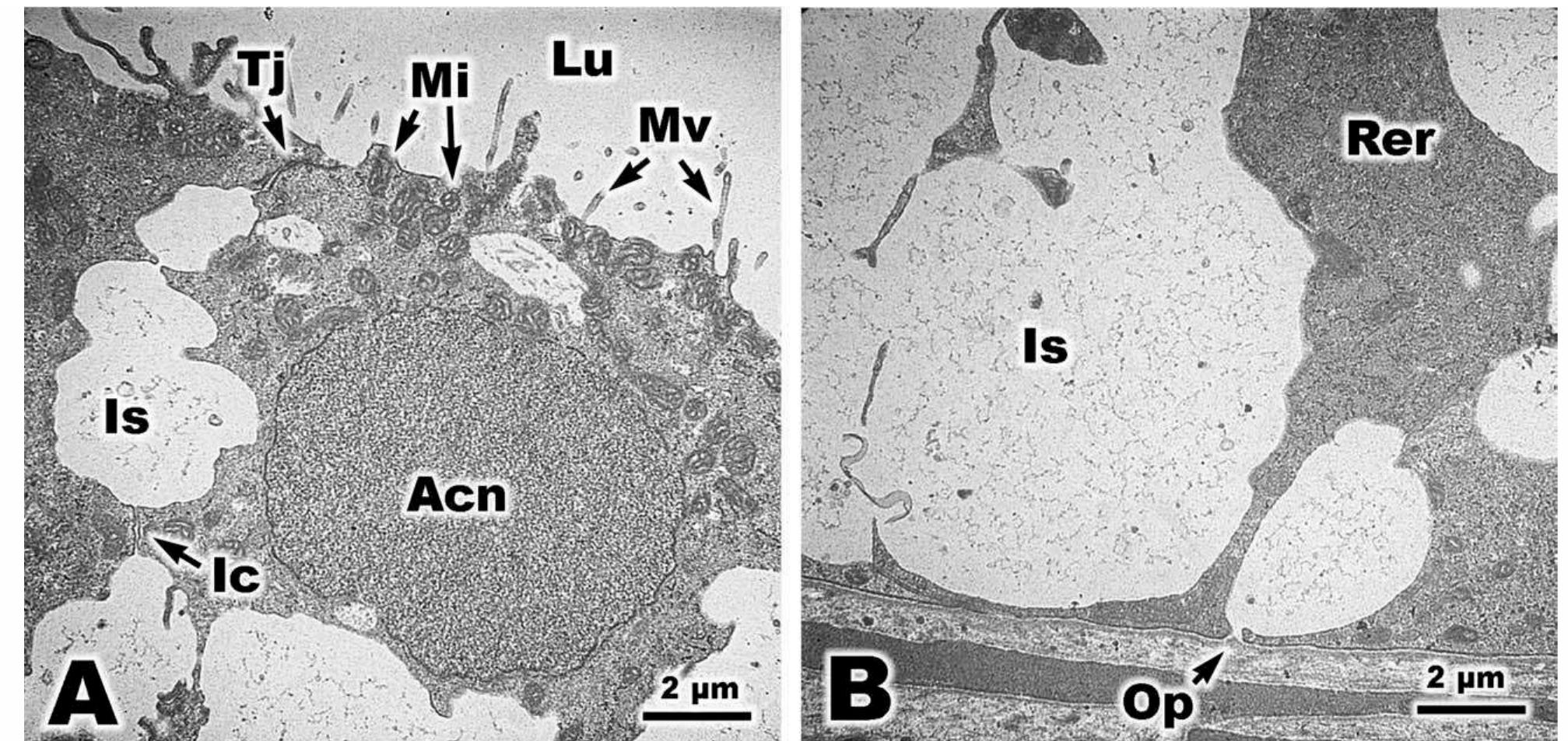 Tem of apical cells and basal border of the ductus
