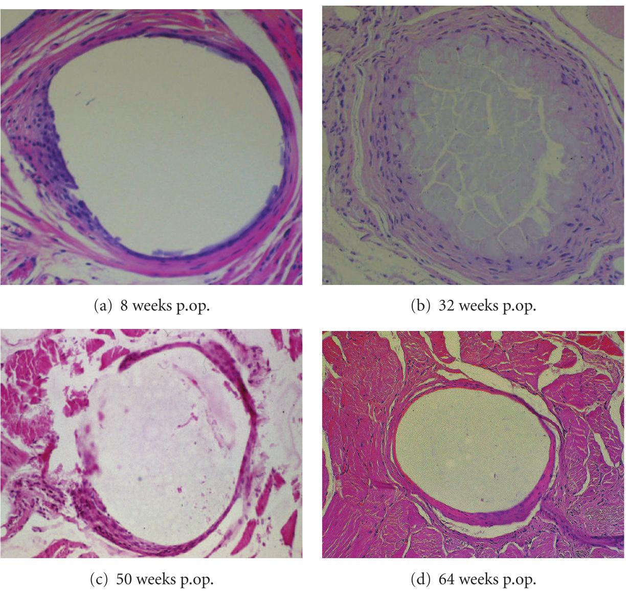 Histology images of eto sterilized p4hb monofilament size