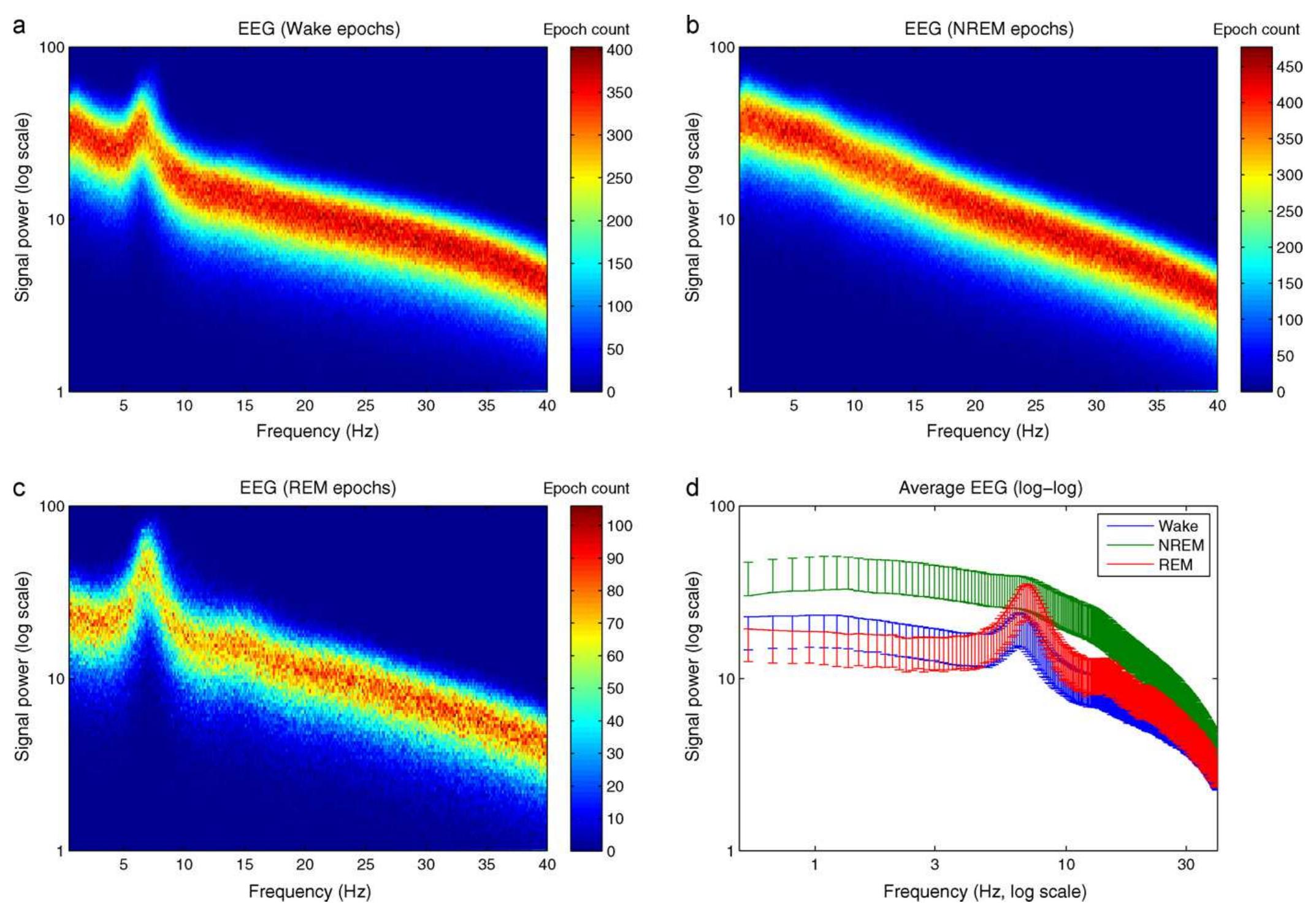 Heat maps of the eeg power and frequency distribution of (a)