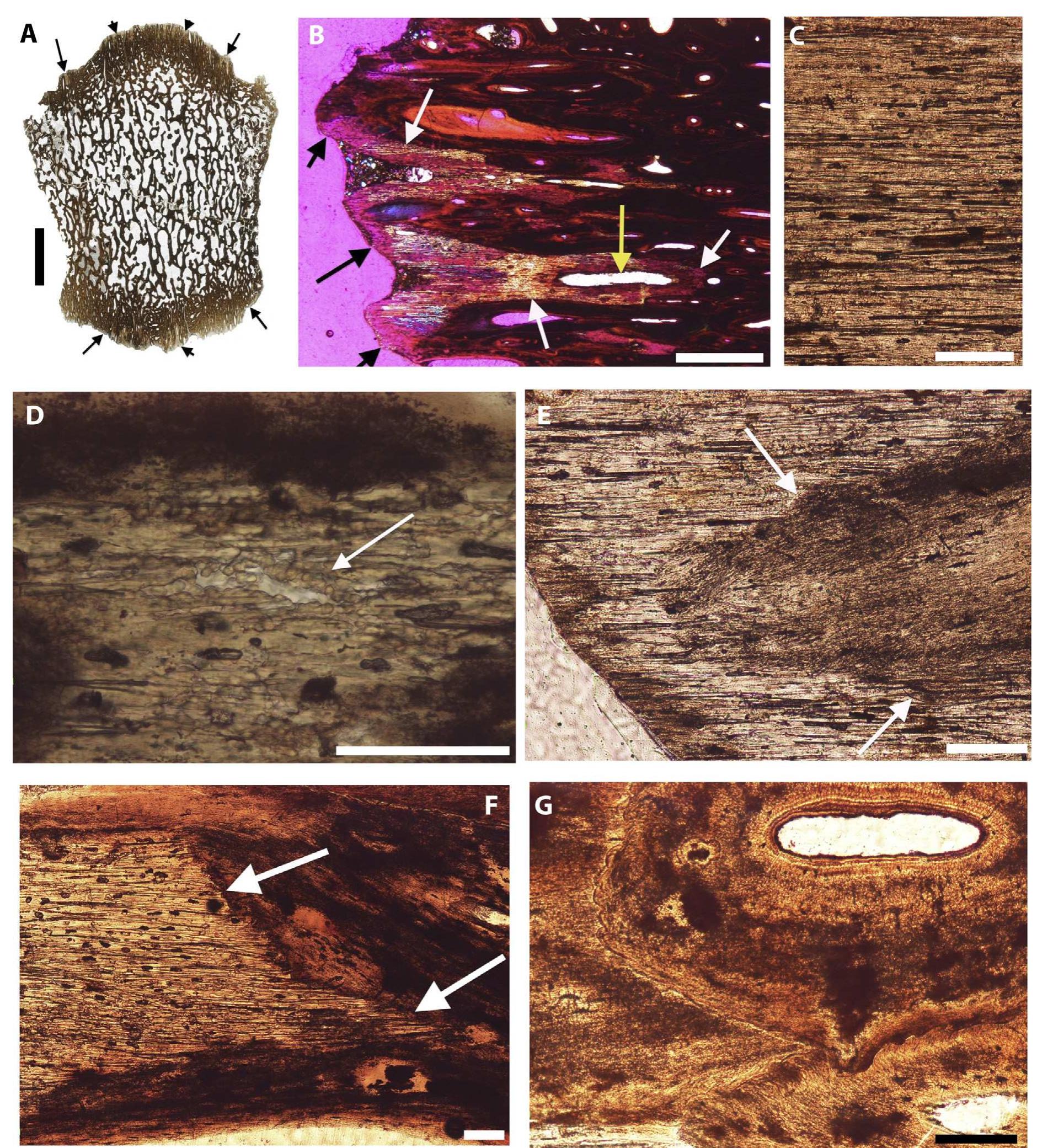 (color online.) transverse and sagittal sections through the