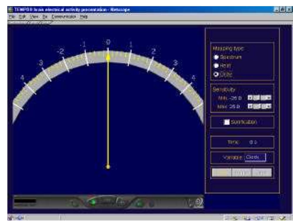 A multimodal interface for simple eeg-based biofeedback