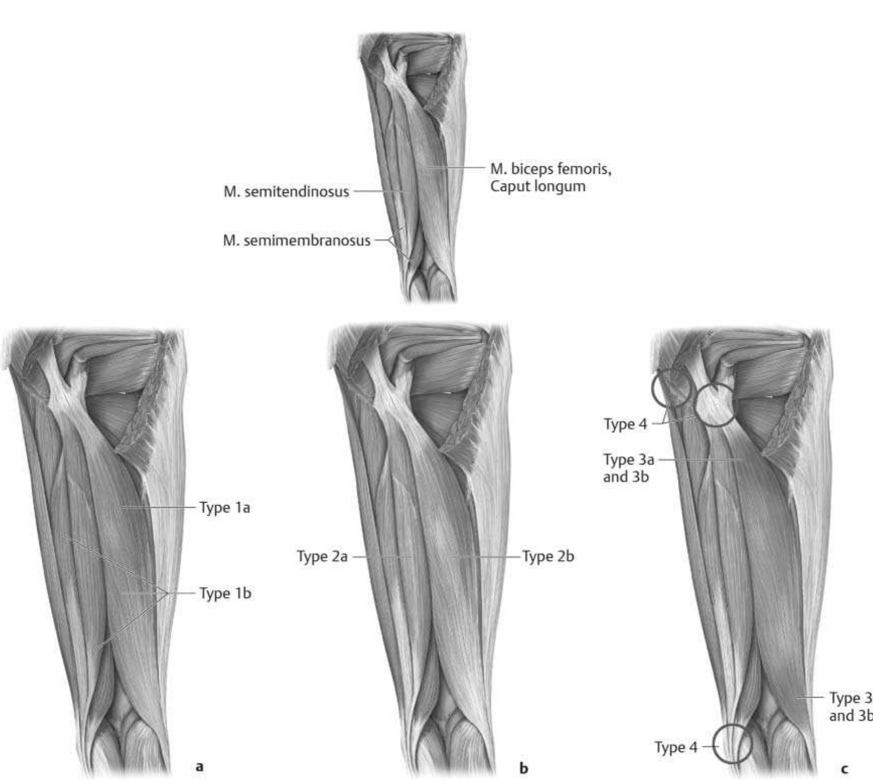 (PDF) Terminology and classification of muscle injuries in sport: The ...