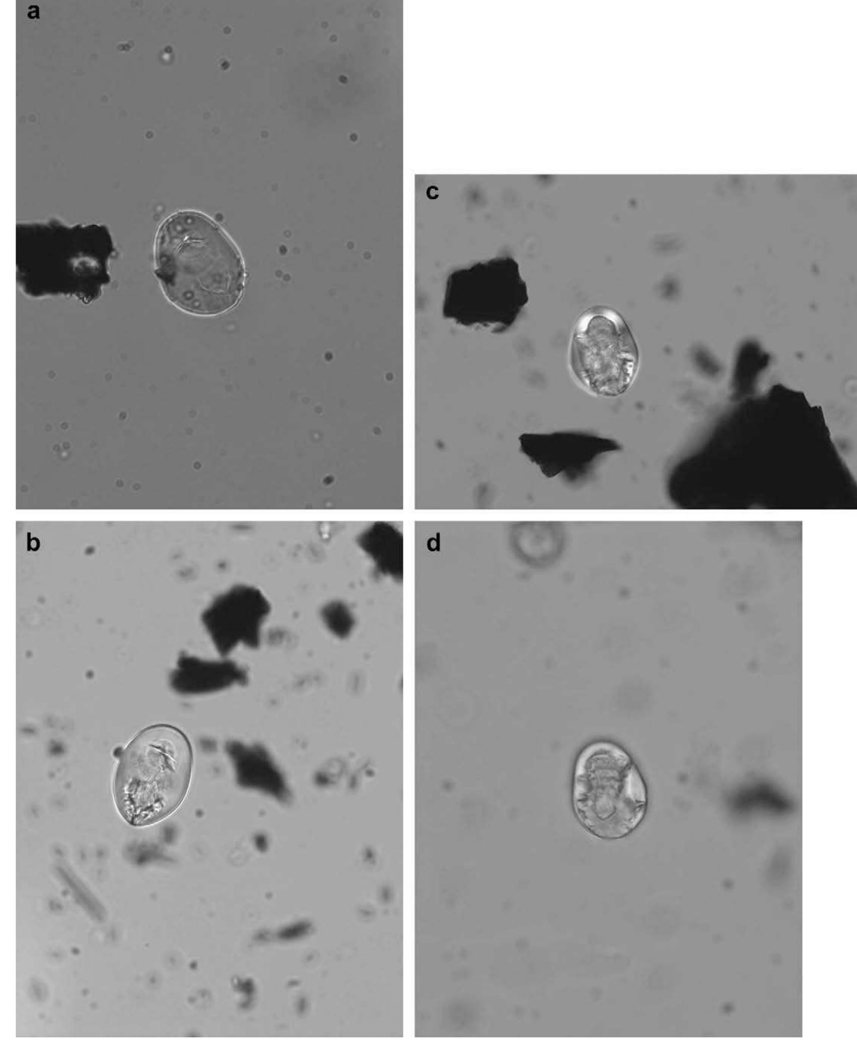 Degradation sequence, following injection of «-amylase, of