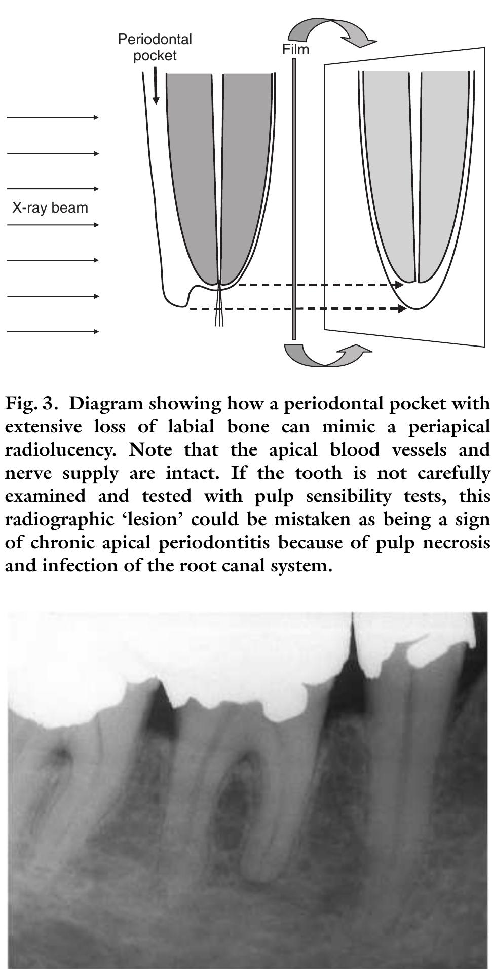 Figure 5 - Classification, diagnosis and clinical