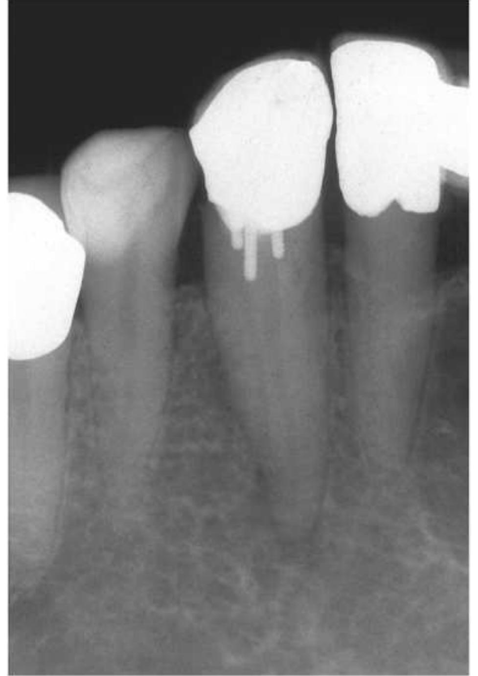 (PDF) Classification, diagnosis and clinical manifestations of apical ...