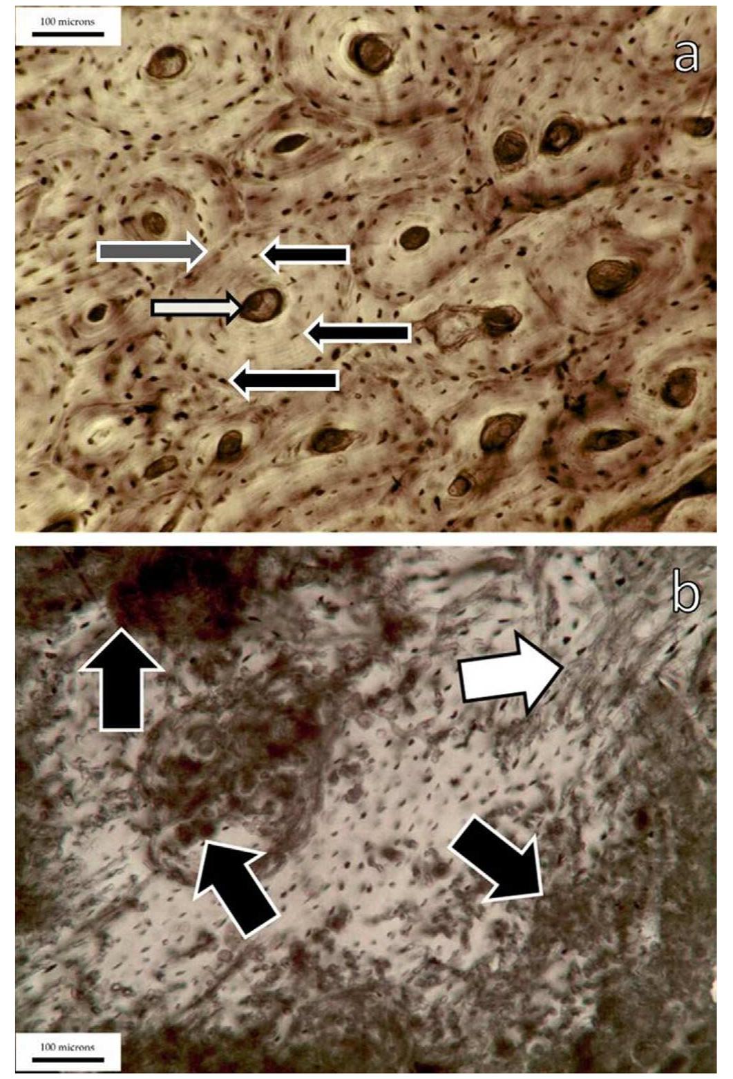 A) transverse micrograph of a fresh human femoral thin