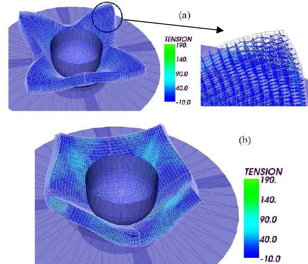 Hemispherical deep drawing of a thick interlock preform