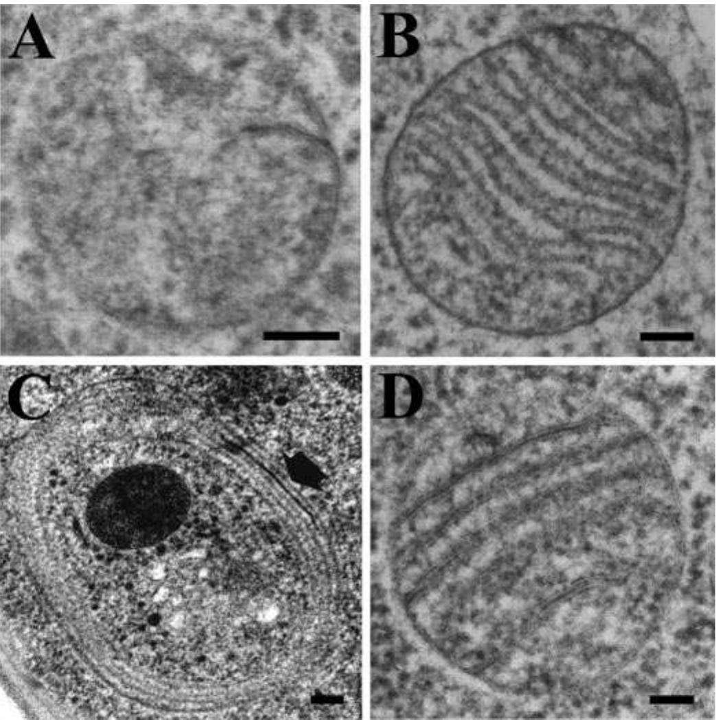Alteration of inner structures of mitochondria from rfy5-1