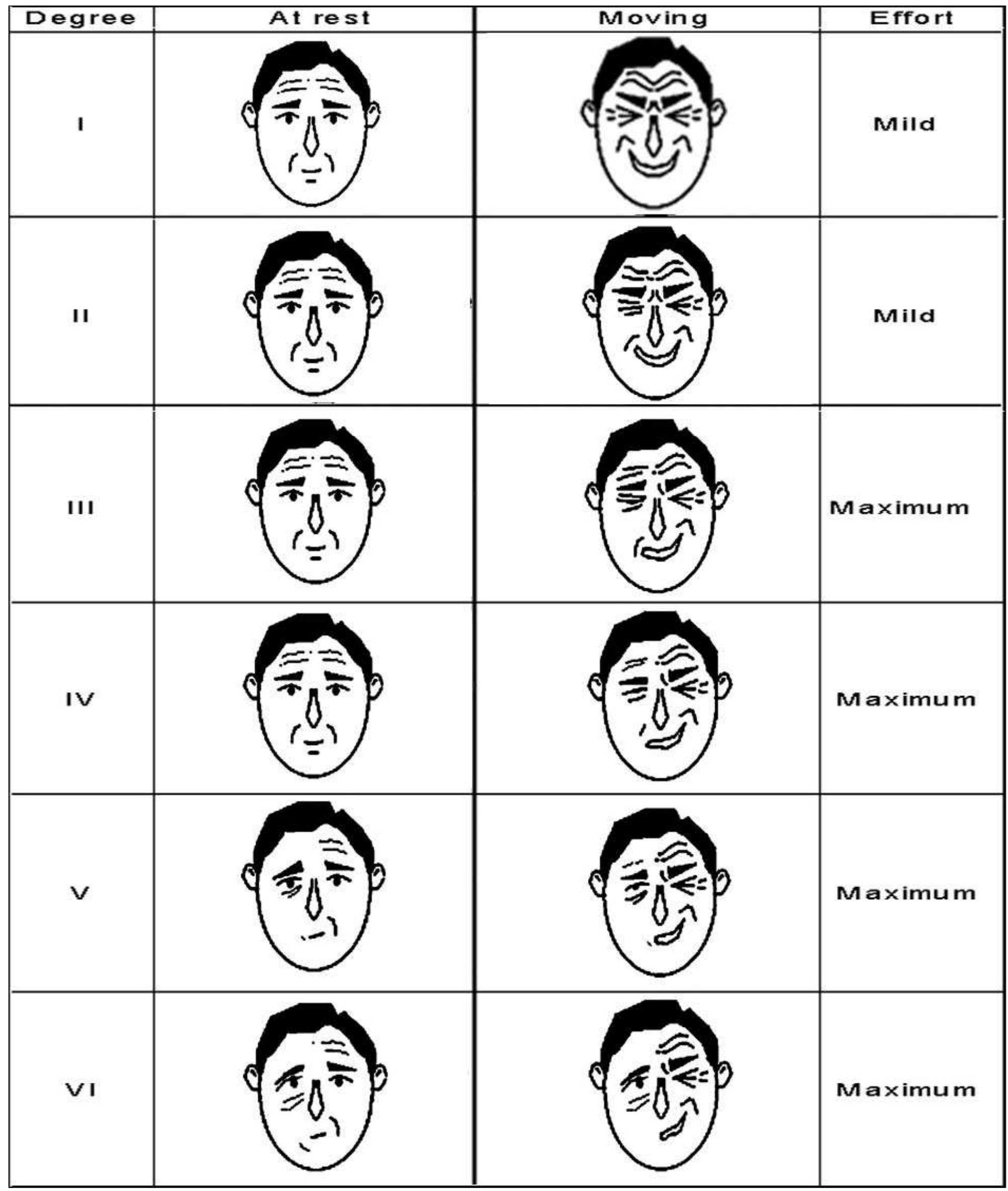 Schematic diagram of the patient’s face at rest and moving