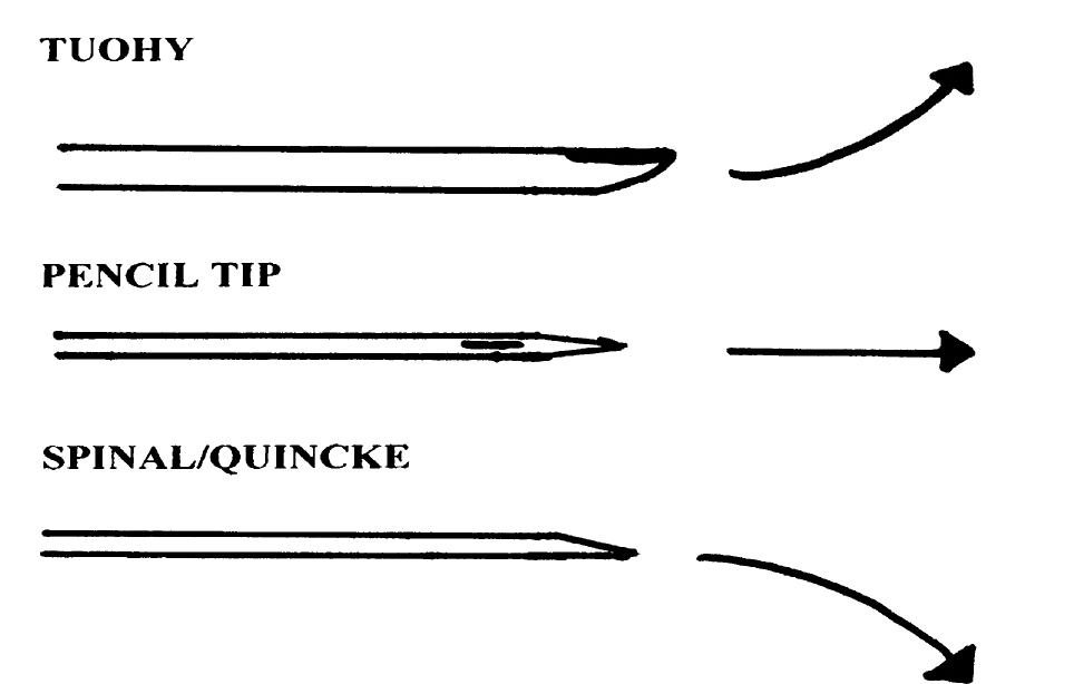 Examples of needle types and deviation direction. a tuohy or