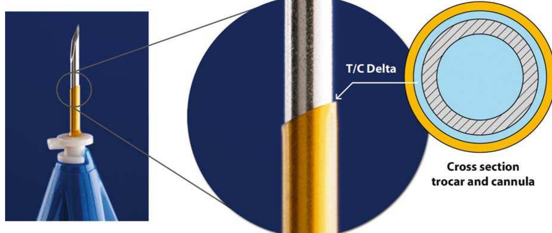 7 illustration of trocar/cannula delta the next critical